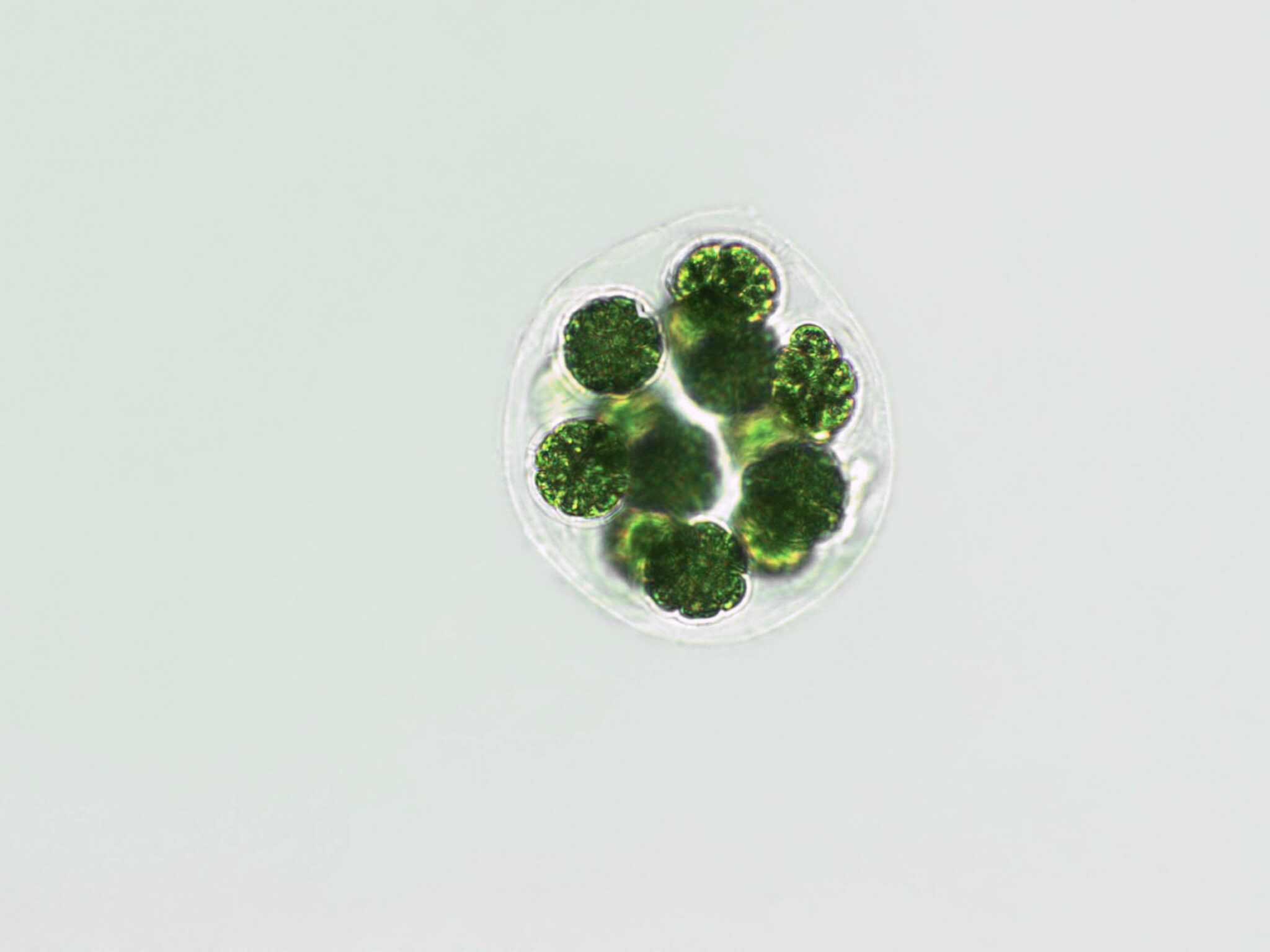 Microalgae Microbiomes – A natural source for the prevention and ...